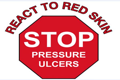 Stop Pressure Ulcer Day 5 Tips For Preventing Pressure Ulcers